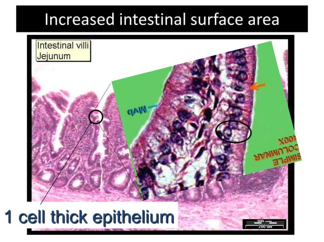 S5 Small Intestines II | PPT