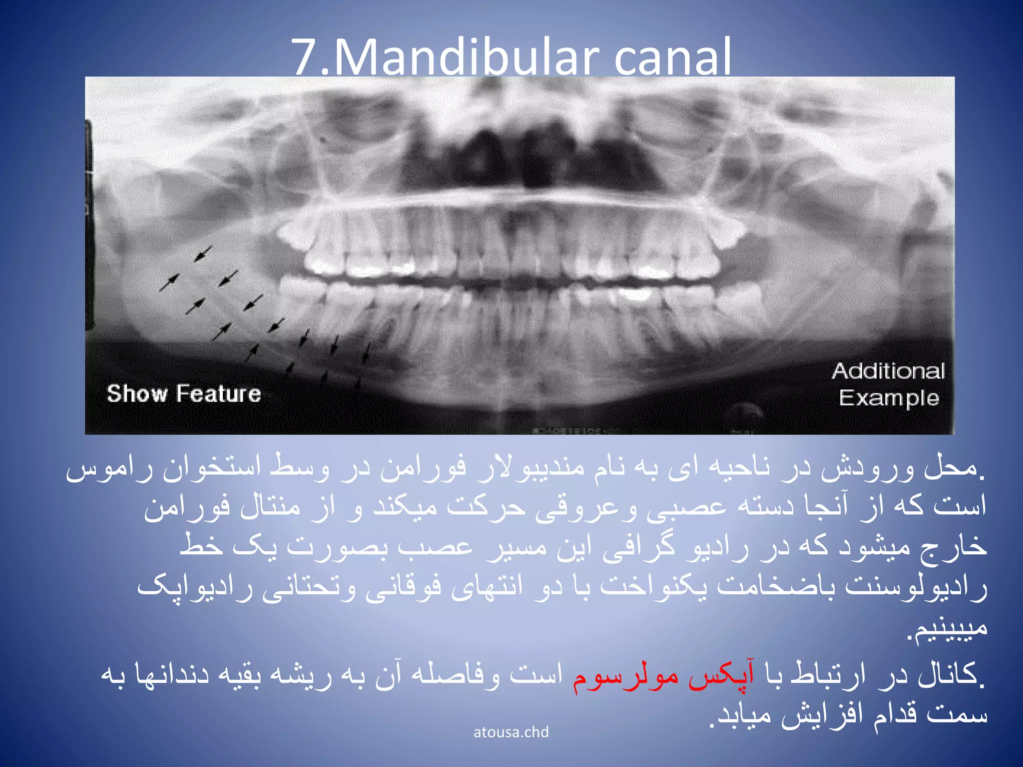 Mandible landmarks | PPT