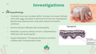 Scabies & Parasitic Infestations (Impetigo) | PPTX