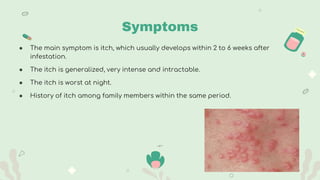 Scabies & Parasitic Infestations (Impetigo) | PPTX