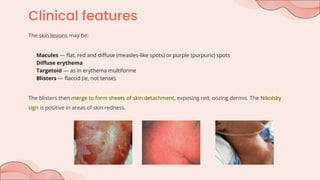 Cutaneous Drug Adverse Reaction seminar.pptx