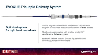 Evoque for TMVR and for Tricuspid Replacement | PPT