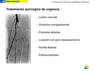 Fracturas del platillo tibial | PDF