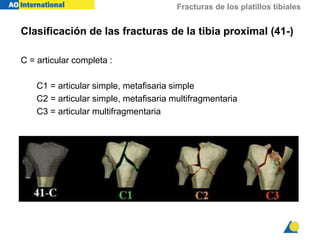Fracturas del platillo tibial | PDF