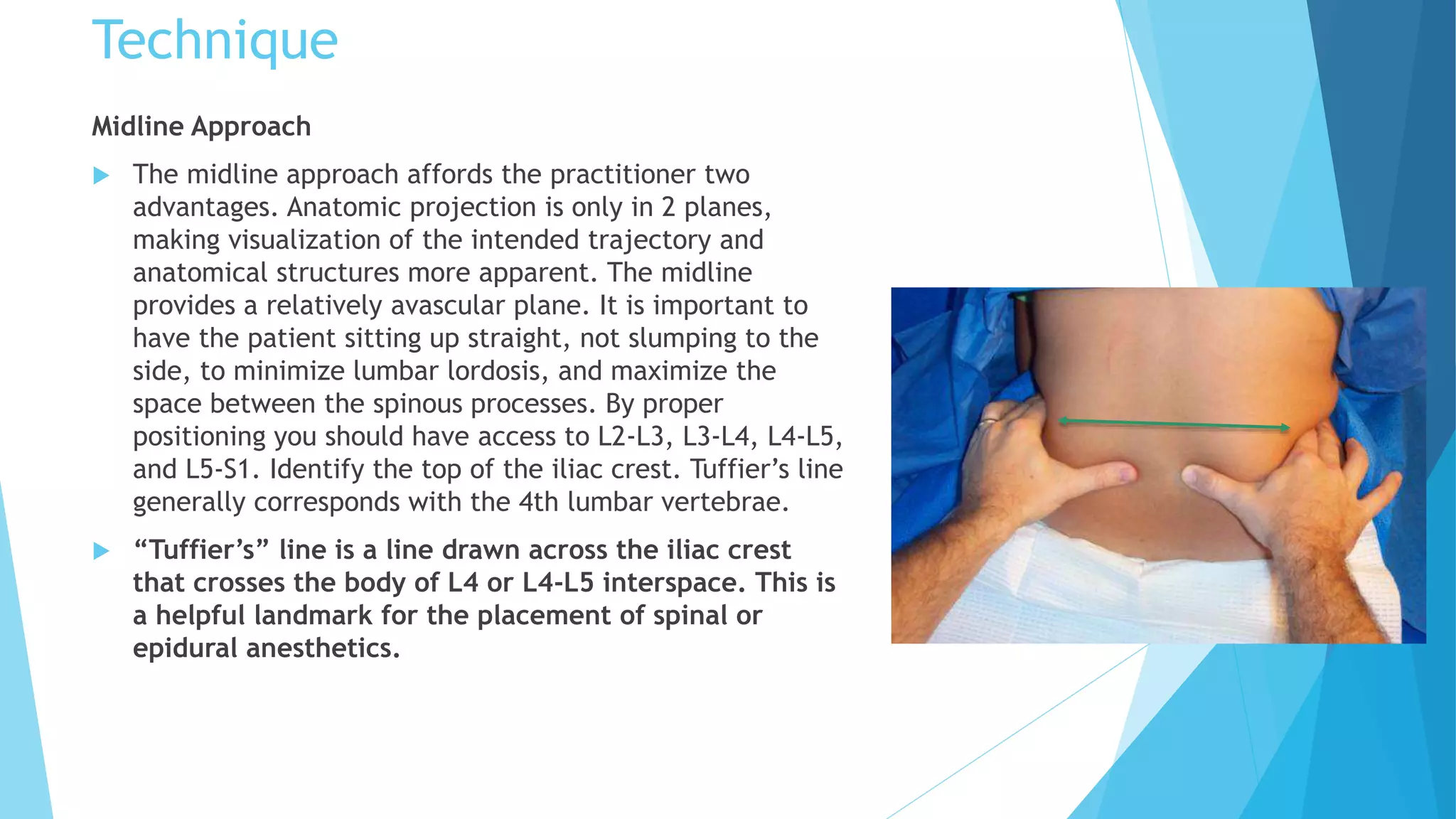Spinal Anesthesia - A Comprehensive Approach | PPTX