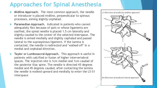 Spinal Anesthesia - A Comprehensive Approach