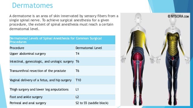 Spinal Anesthesia - A Comprehensive Approach