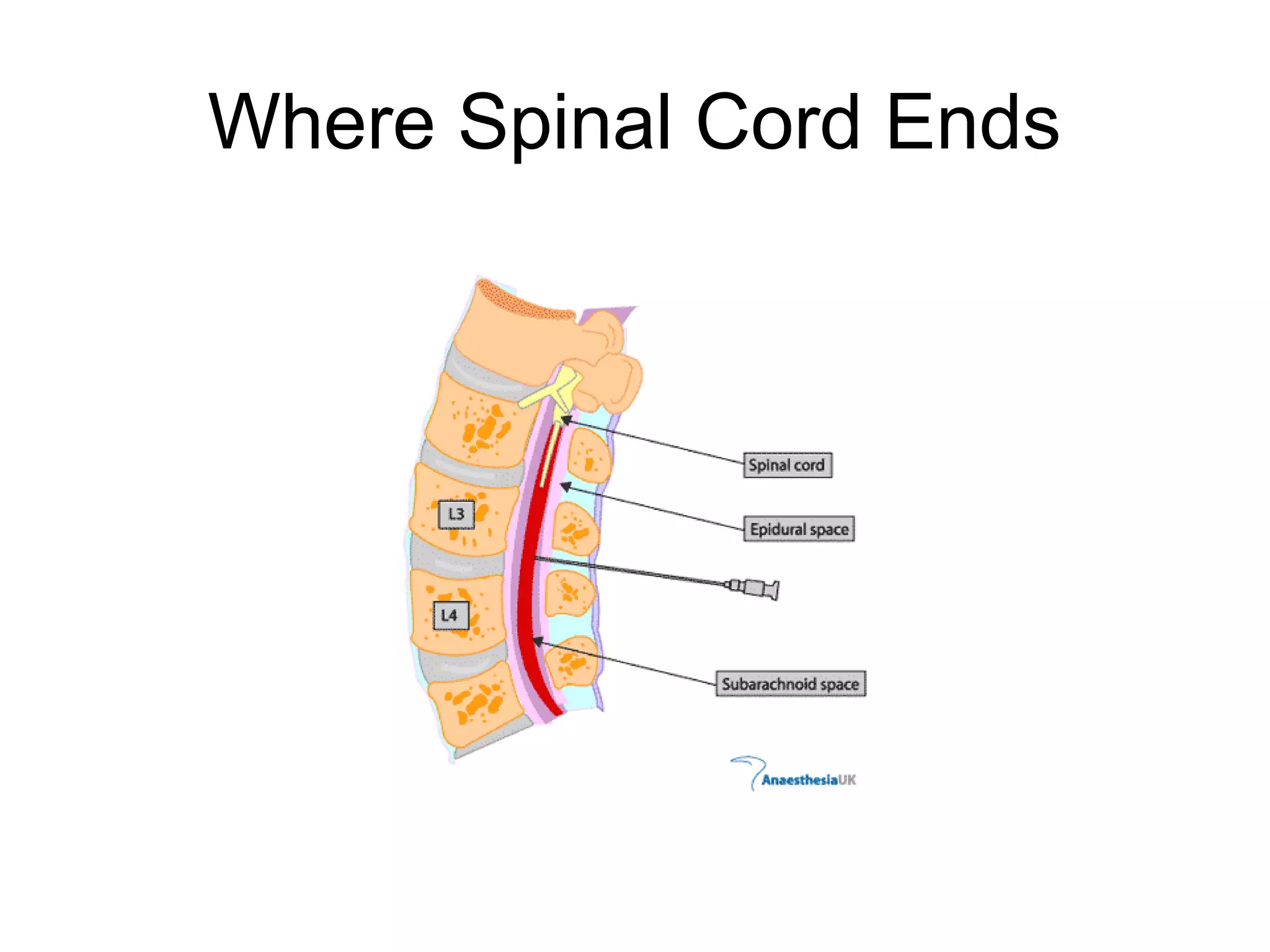 SPINAL ANAESTHESIA | PPT
