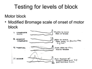 SPINAL ANAESTHESIA | PPT