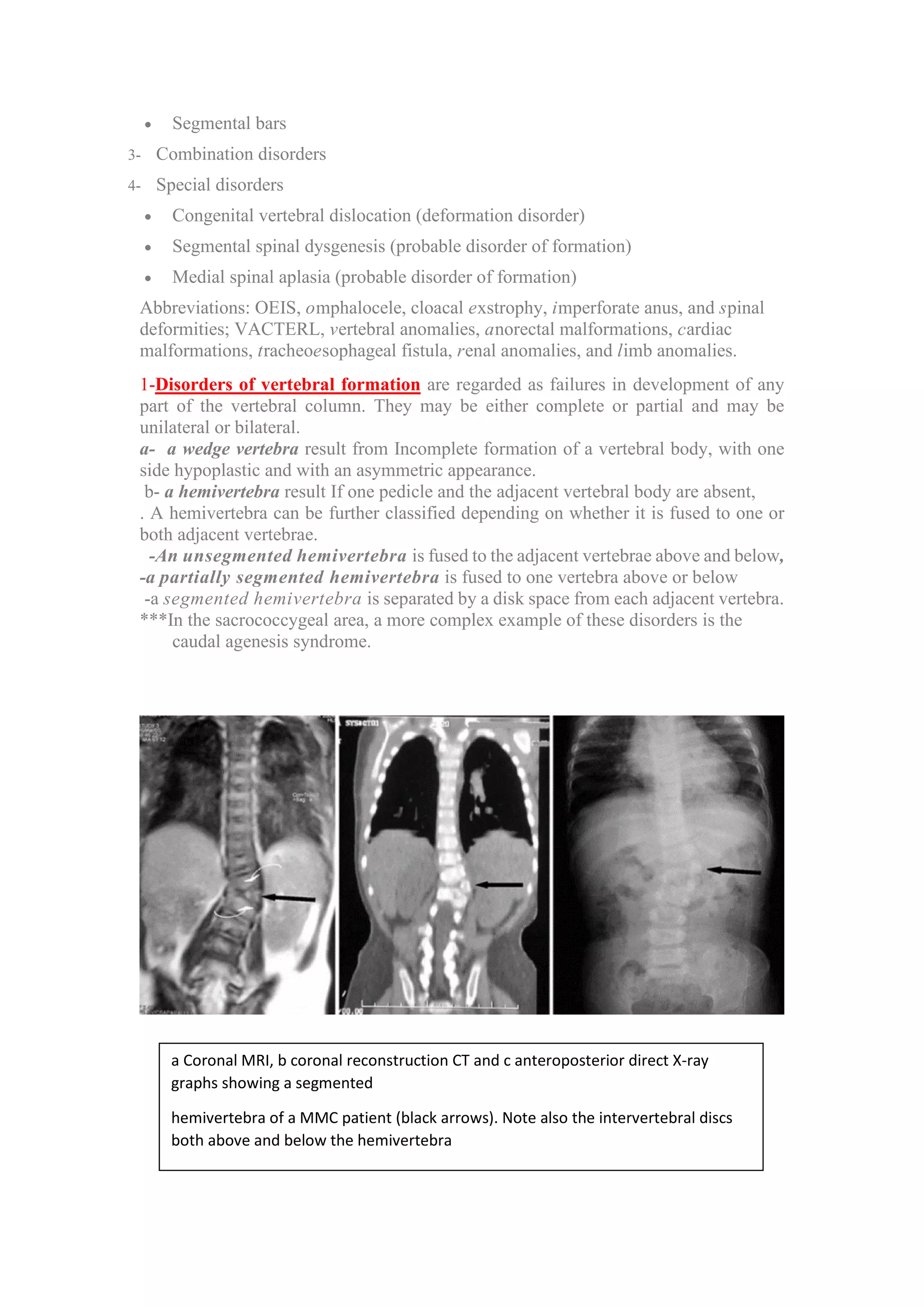 abnormal of vertebral column | PDF