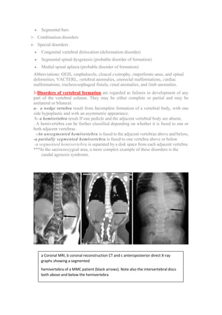 abnormal of vertebral column | PDF