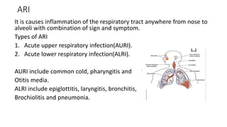 Acute respiratory infection | Social and preventive pharmacy. | PPTX