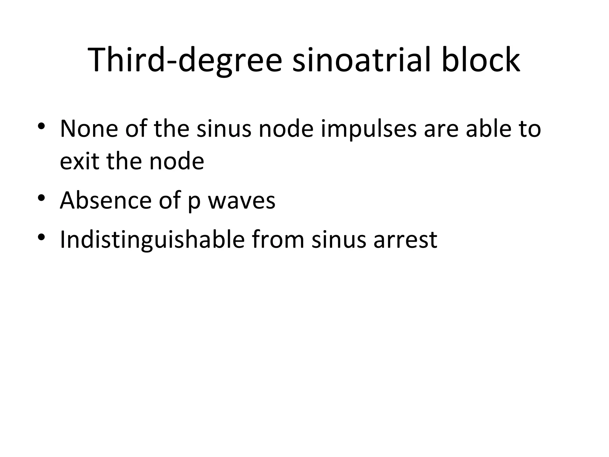 ECG Lecture: Sinus arrest, sinoatrial exit block, AV block and escape ...