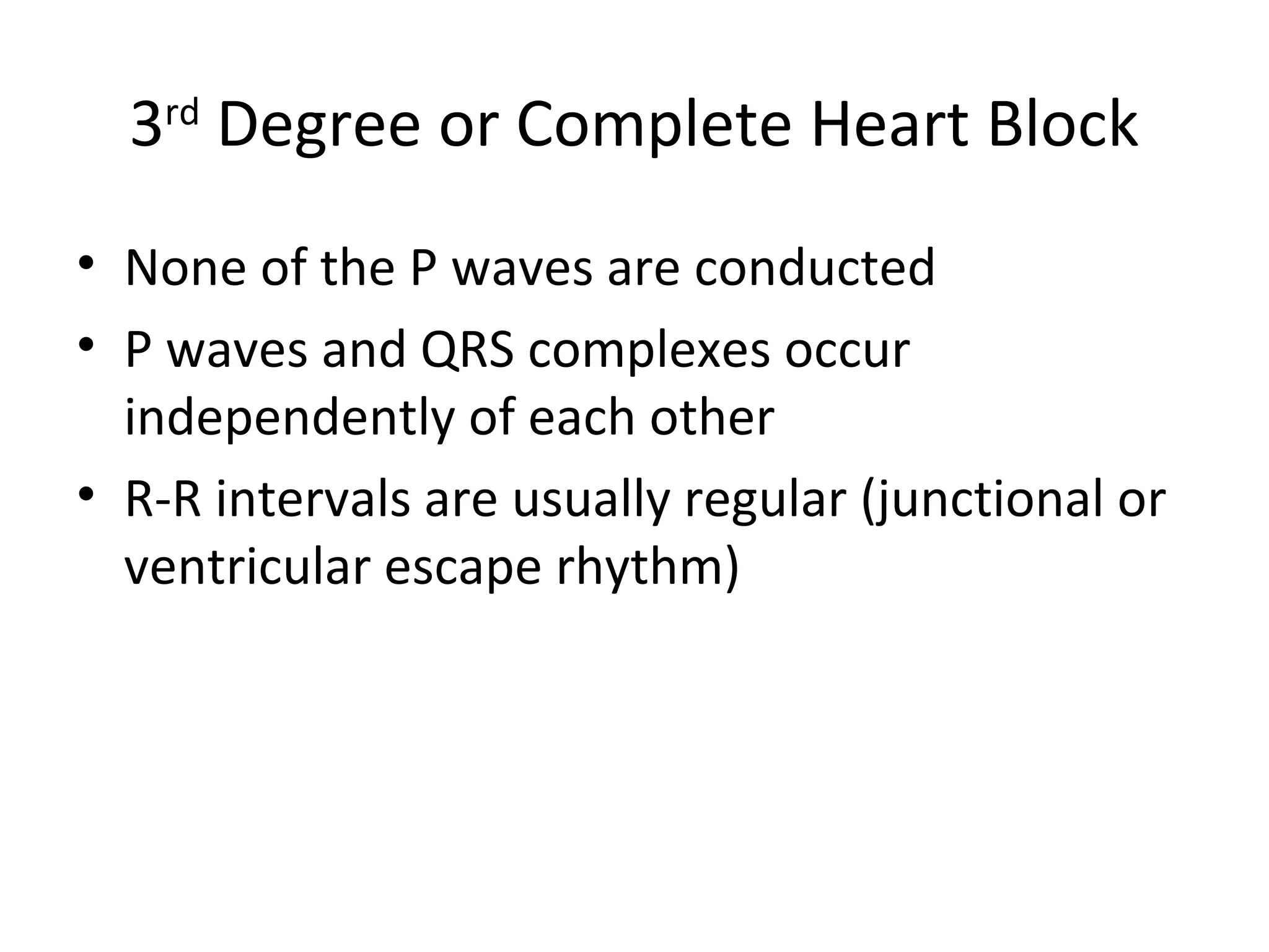 ECG Lecture: Sinus arrest, sinoatrial exit block, AV block and escape ...