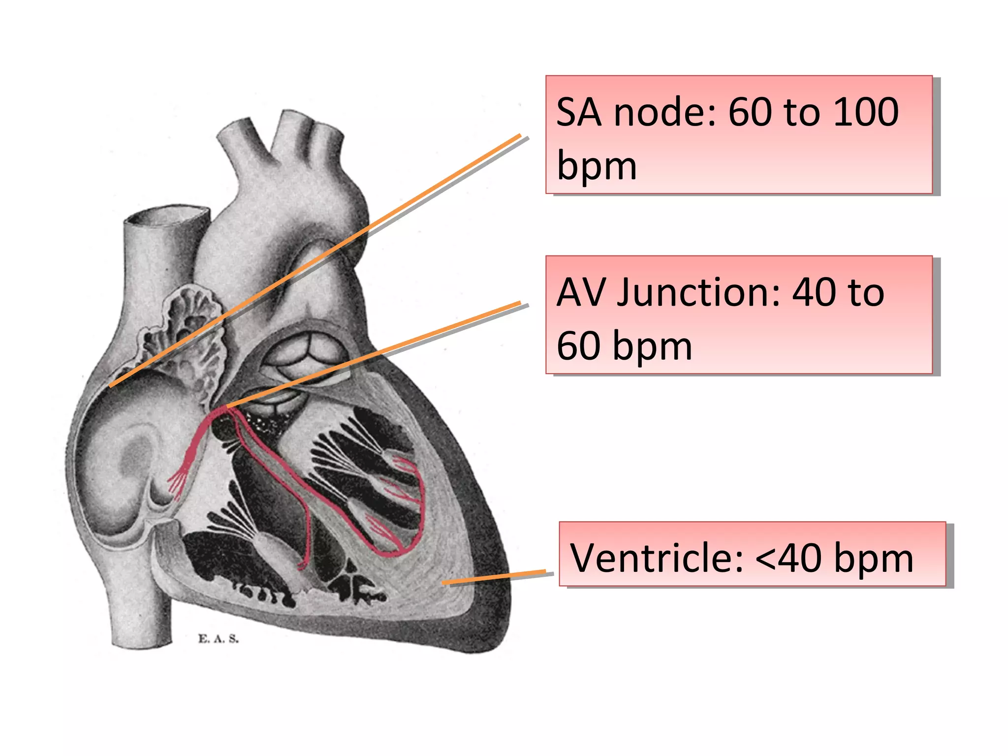 ECG Lecture: Sinus arrest, sinoatrial exit block, AV block and escape ...