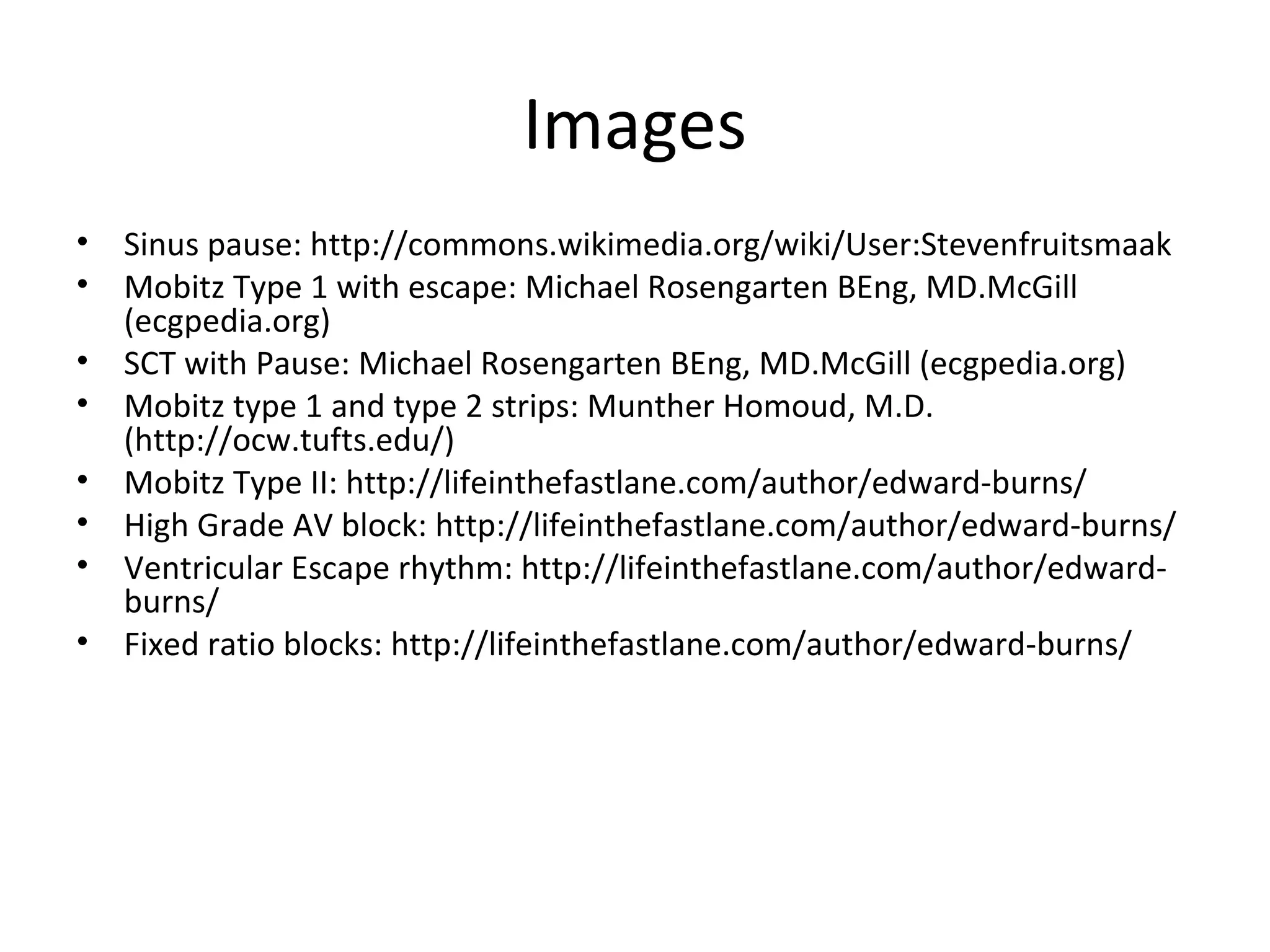 ECG Lecture: Sinus arrest, sinoatrial exit block, AV block and escape ...