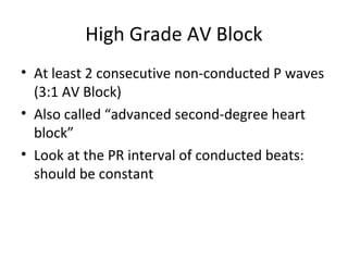 ECG Lecture: Sinus arrest, sinoatrial exit block, AV block and escape ...
