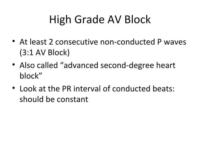 ECG Lecture: Sinus arrest, sinoatrial exit block, AV block and escape ...