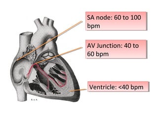 ECG Lecture: Sinus arrest, sinoatrial exit block, AV block and escape ...
