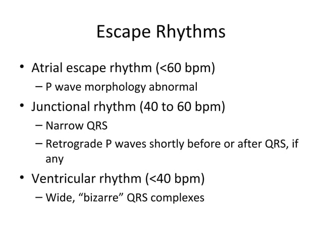 ECG Lecture: Sinus arrest, sinoatrial exit block, AV block and escape ...