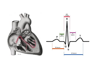 ECG Lecture: Sinus arrest, sinoatrial exit block, AV block and escape ...