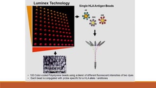 Luminex Single Antigen Bead Assay | PPTX