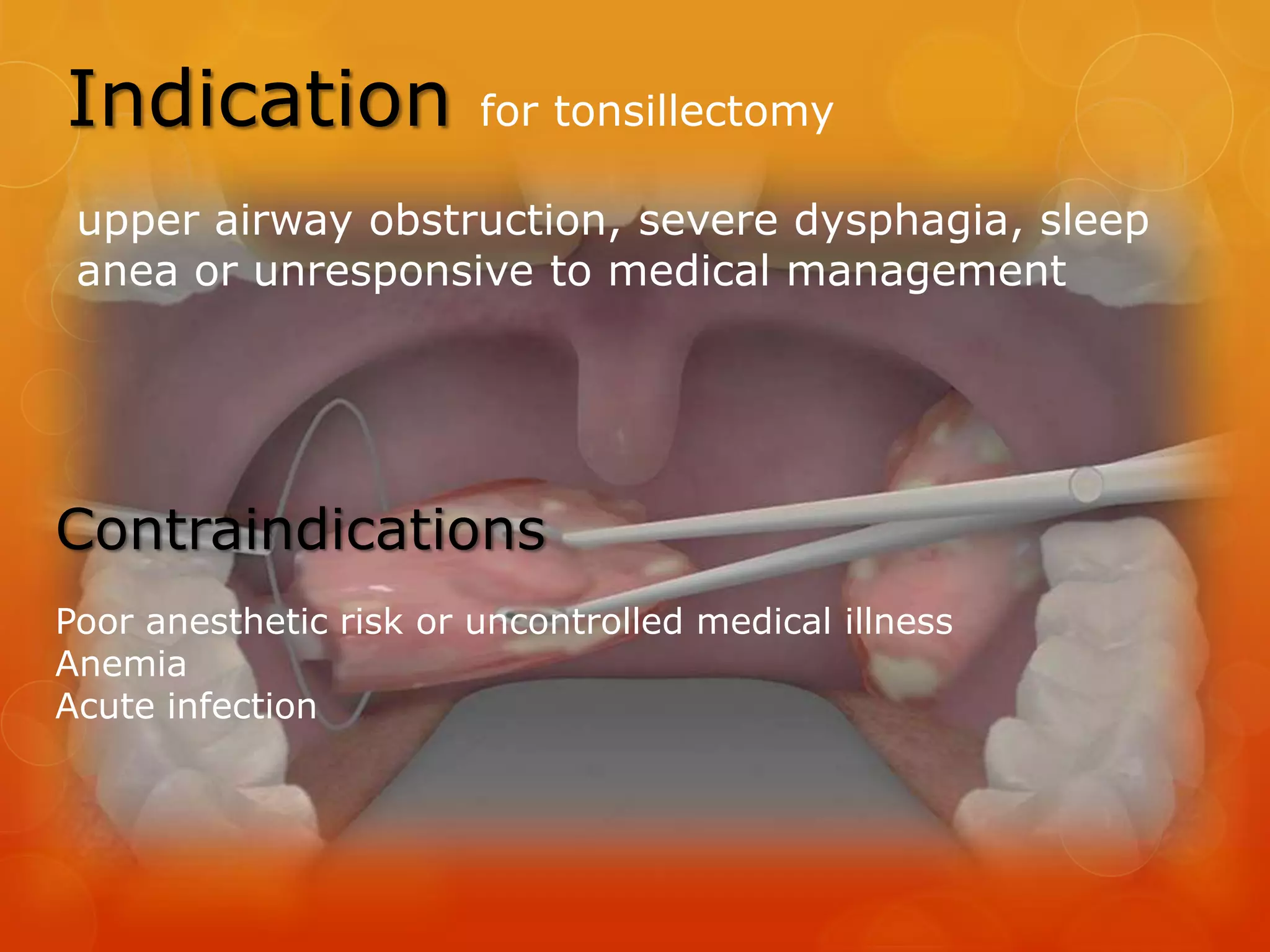 Disease of the Pharynx | PPTX