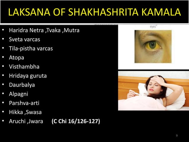 Kamala - An Ayurvedic View | PDF