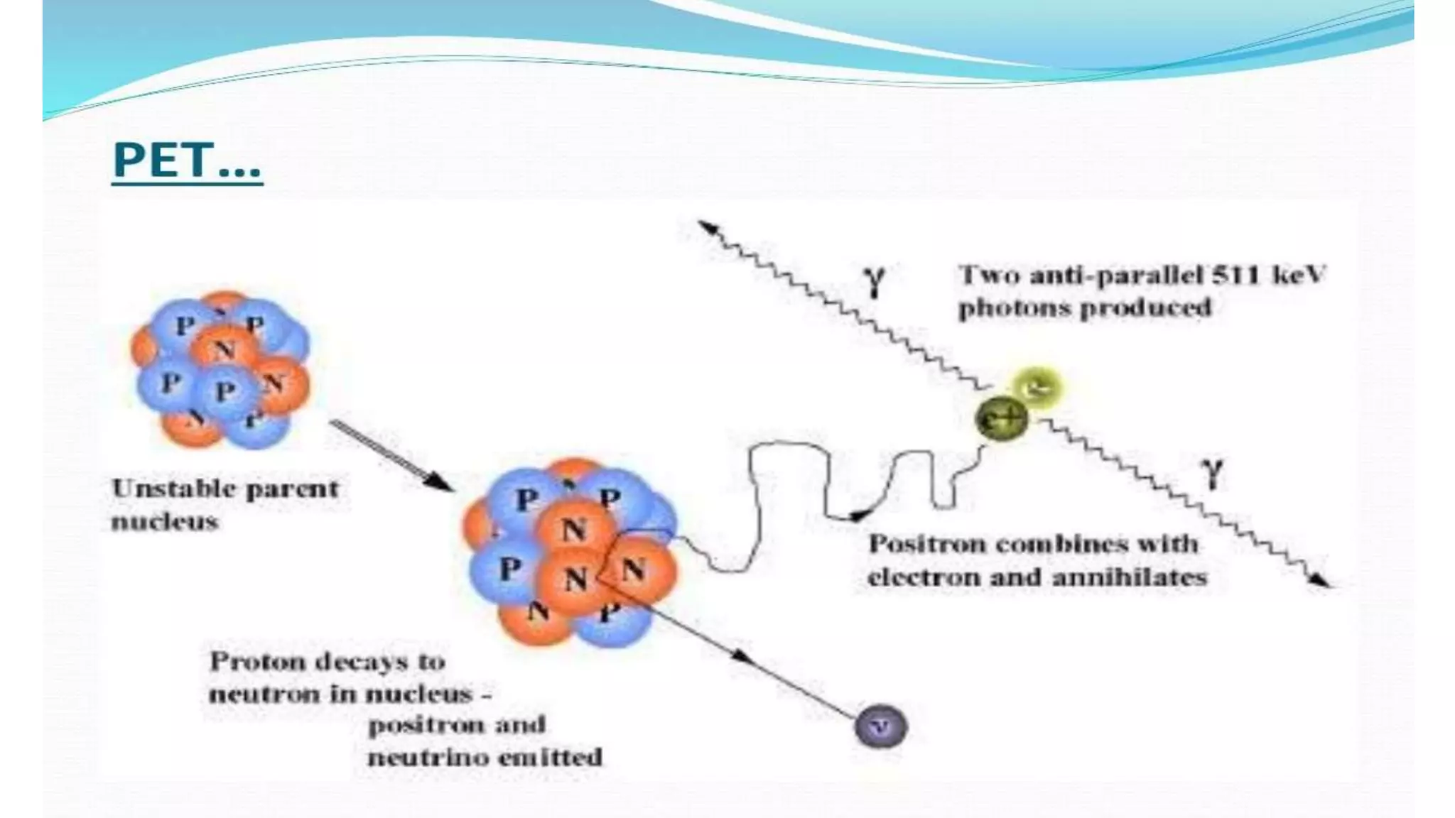Neuroimaging (MRI, PET, SPECT ,fMRI).pptx