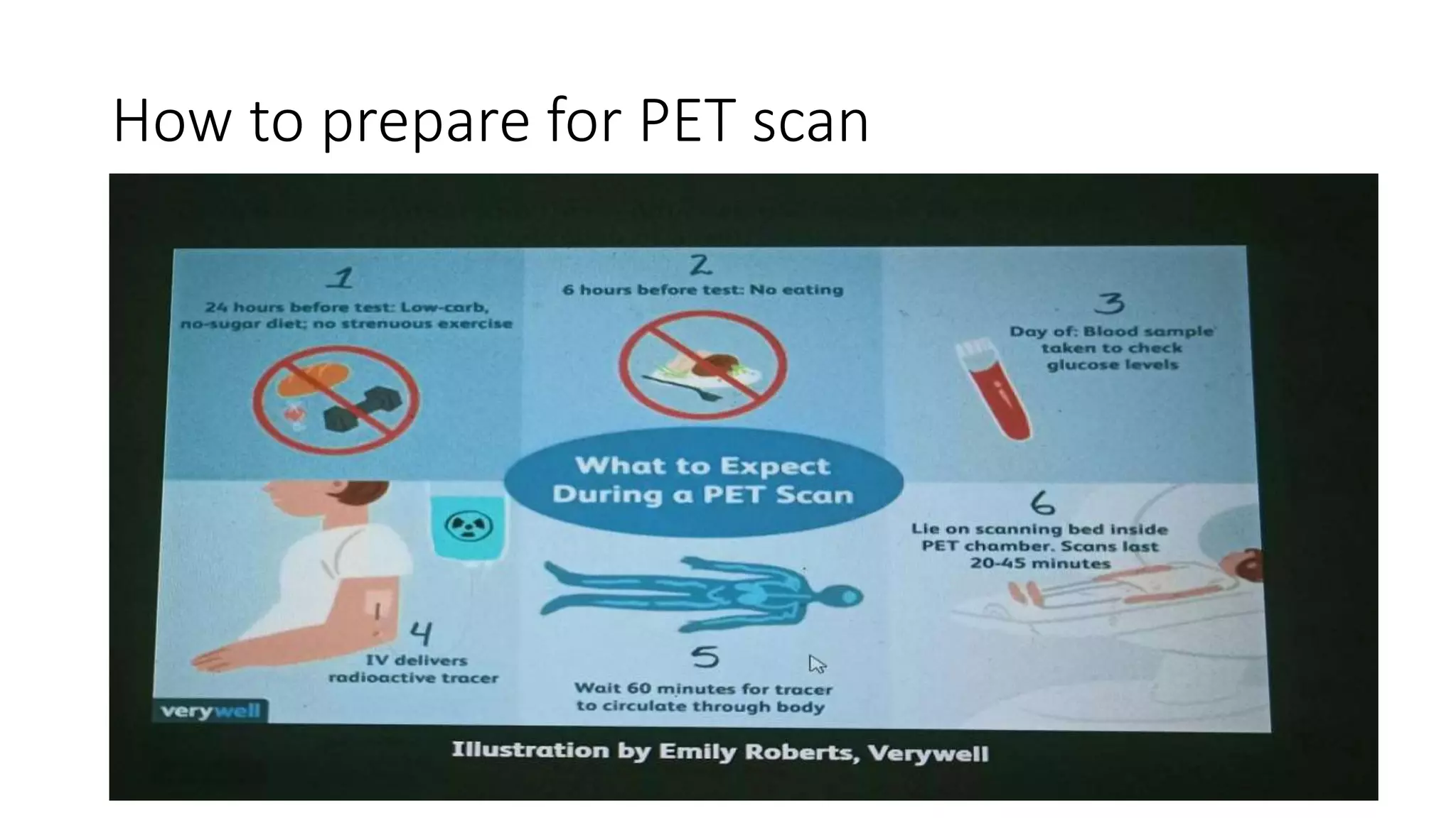 Neuroimaging (MRI, PET, SPECT ,fMRI).pptx
