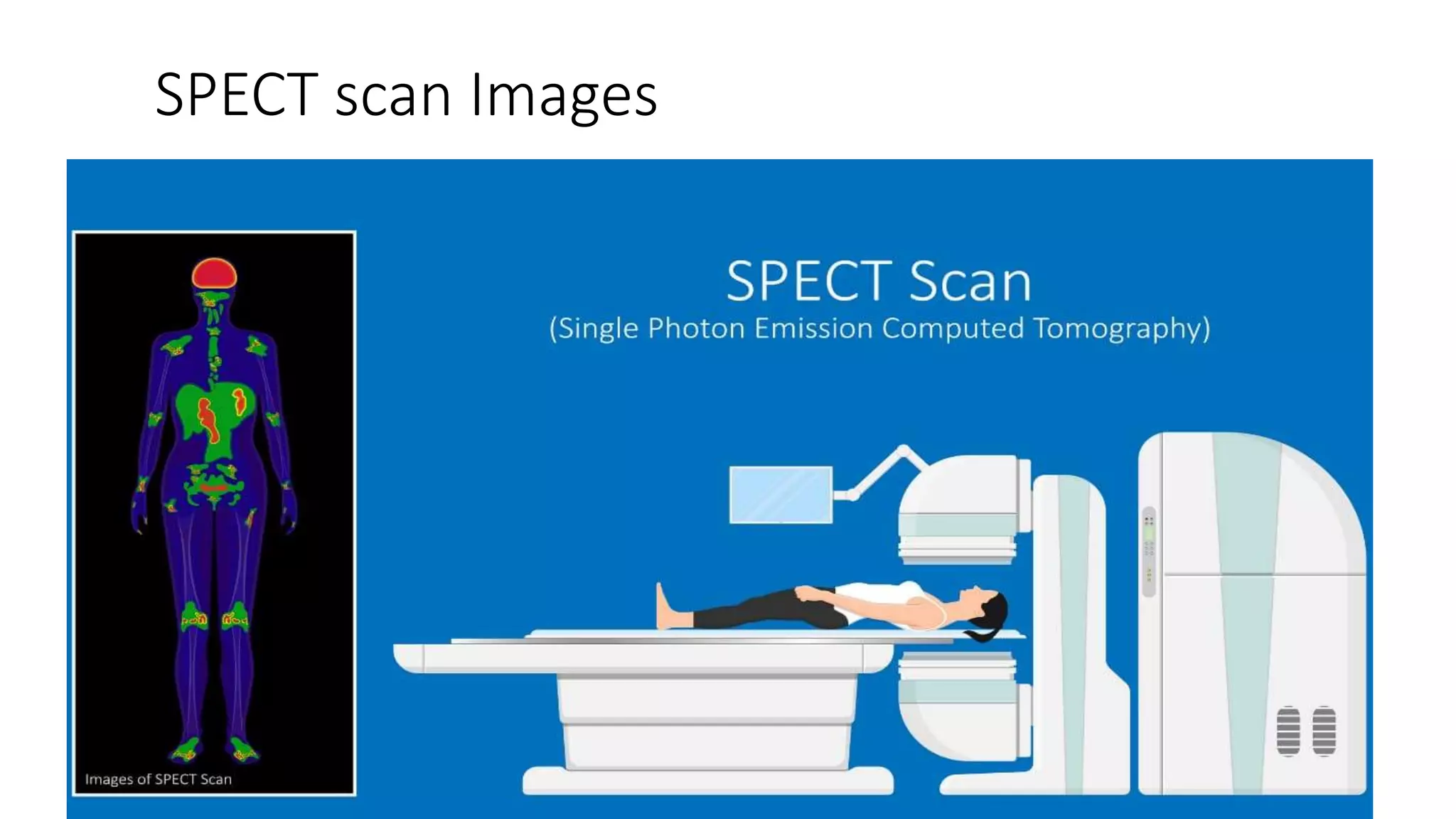Neuroimaging (MRI, PET, SPECT ,fMRI).pptx
