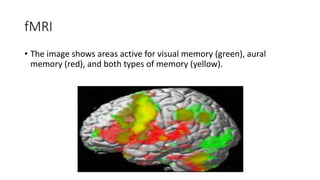 Neuroimaging (MRI, PET, SPECT ,fMRI).pptx