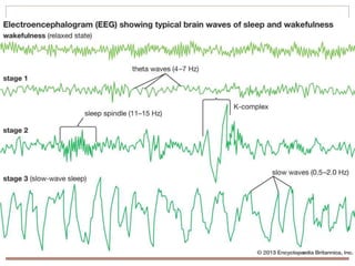 Normal Eeg Tracing