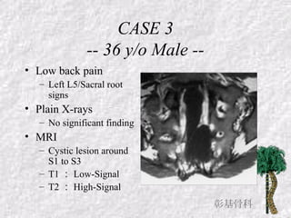 Surgical Treatment of Symptomatic Sacral Cysts | PPT