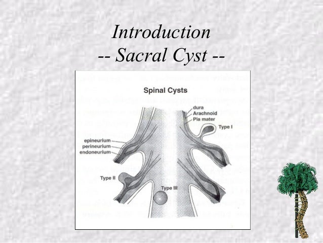 Surgical Treatment of Symptomatic Sacral Cysts