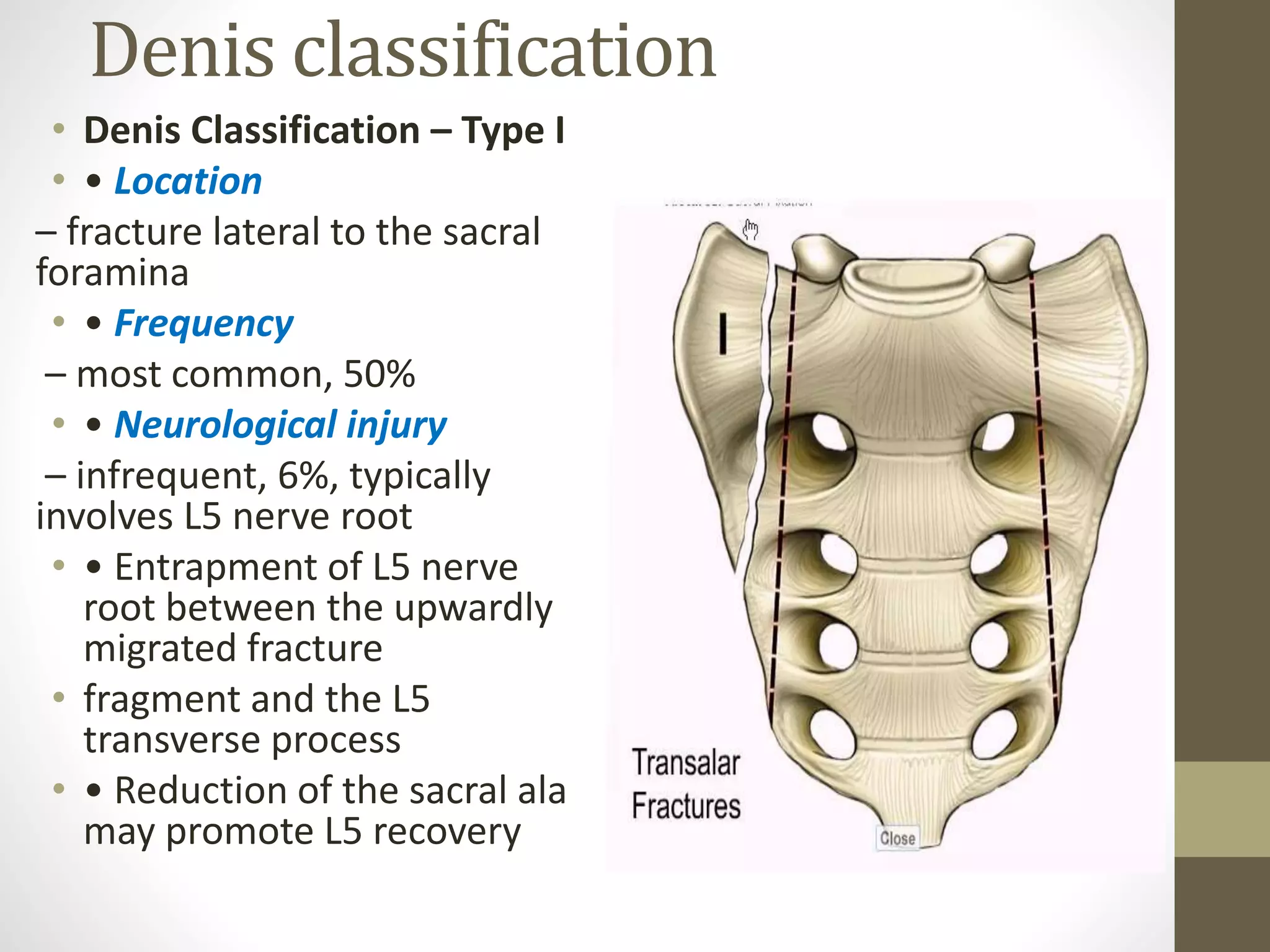 Sacral fracture | PPTX