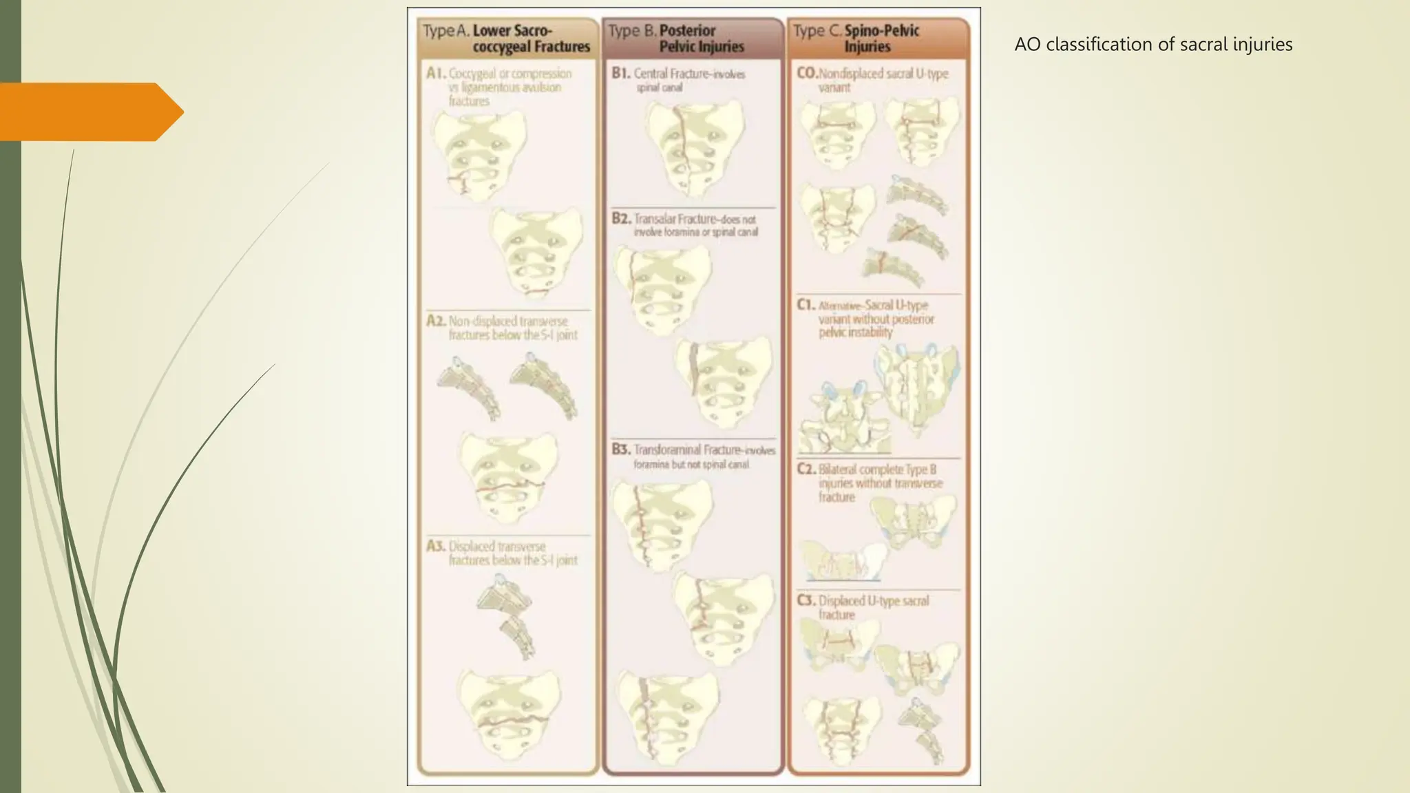 SACRAL FRACTURE or SACRAL TRAUMA POWERPOINT | PPTX | Death, Injury, or ...