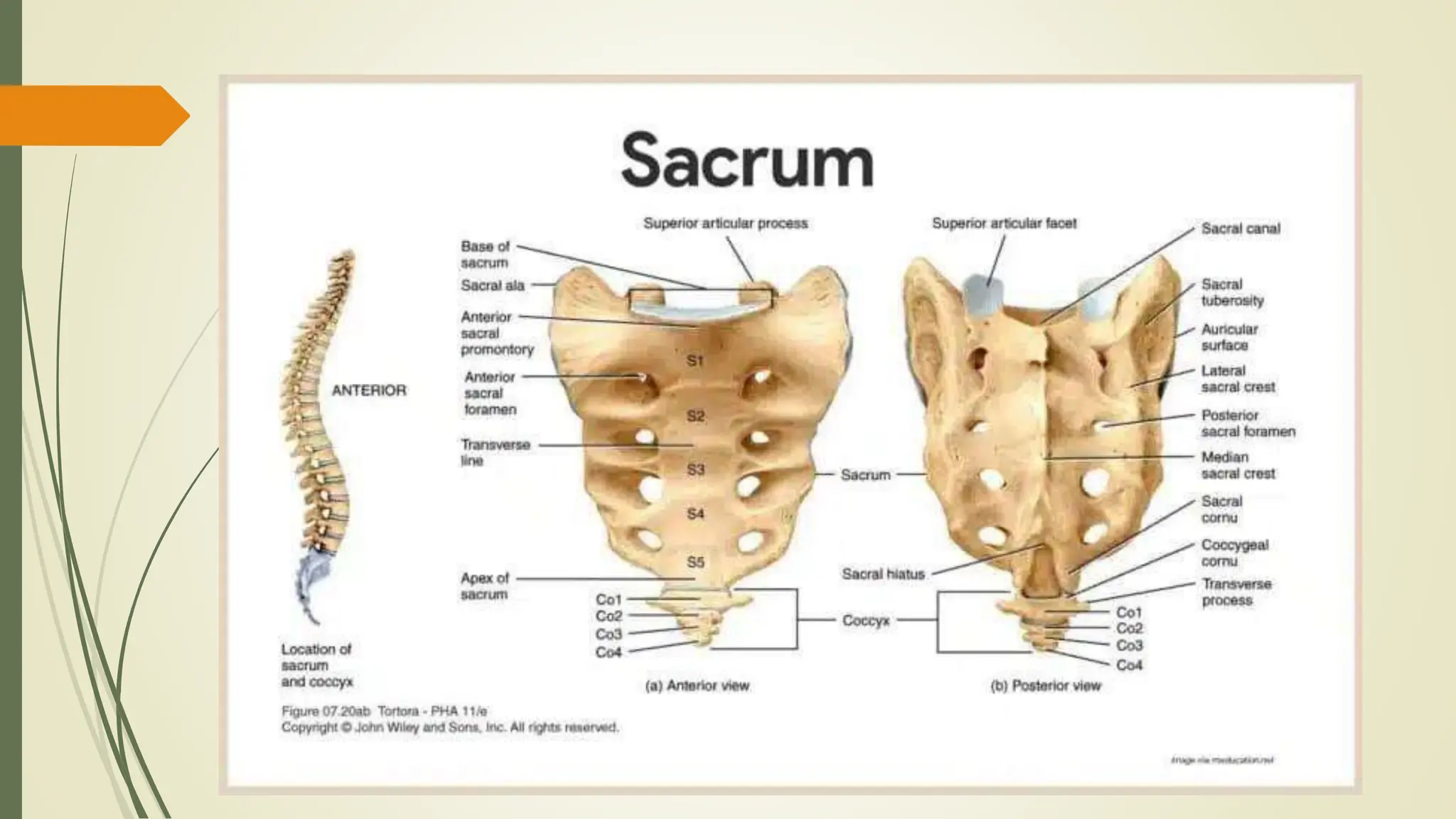 SACRAL FRACTURE or SACRAL TRAUMA POWERPOINT | PPTX | Death, Injury, or Military Conflict ...