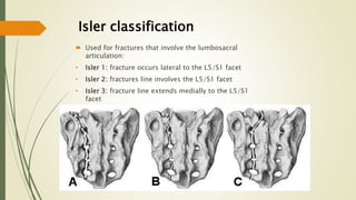 SACRAL FRACTURE or SACRAL TRAUMA POWERPOINT | PPTX | Death, Injury, or ...