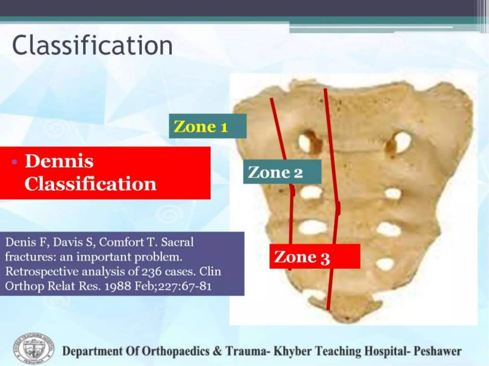 Sacral fractures | PPTX