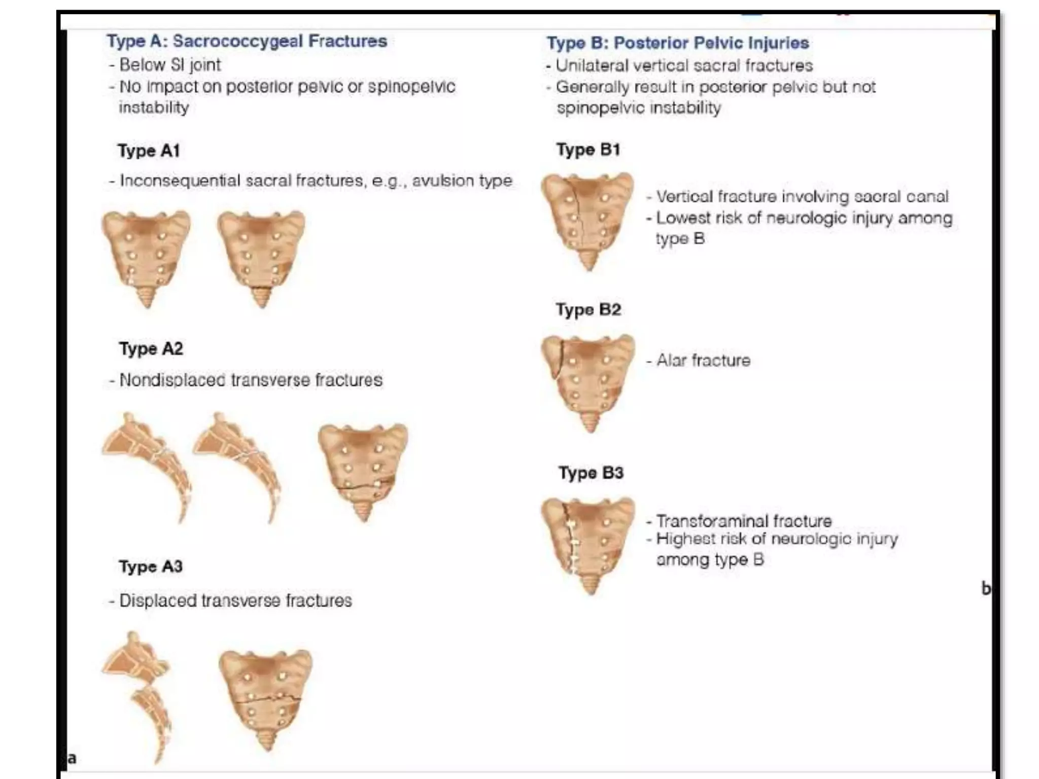 Sacral fractures.pptx
