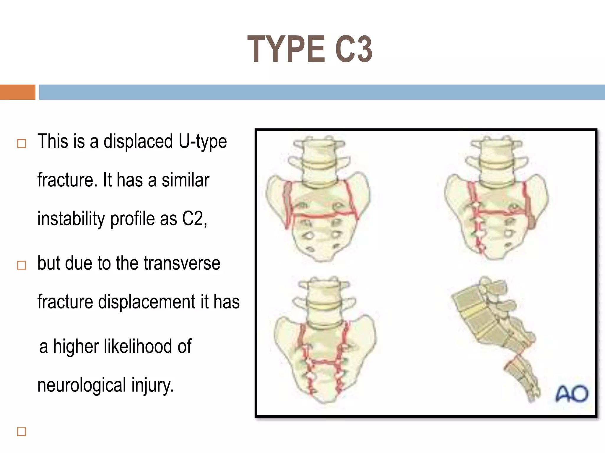 Sacral fractures.pptx