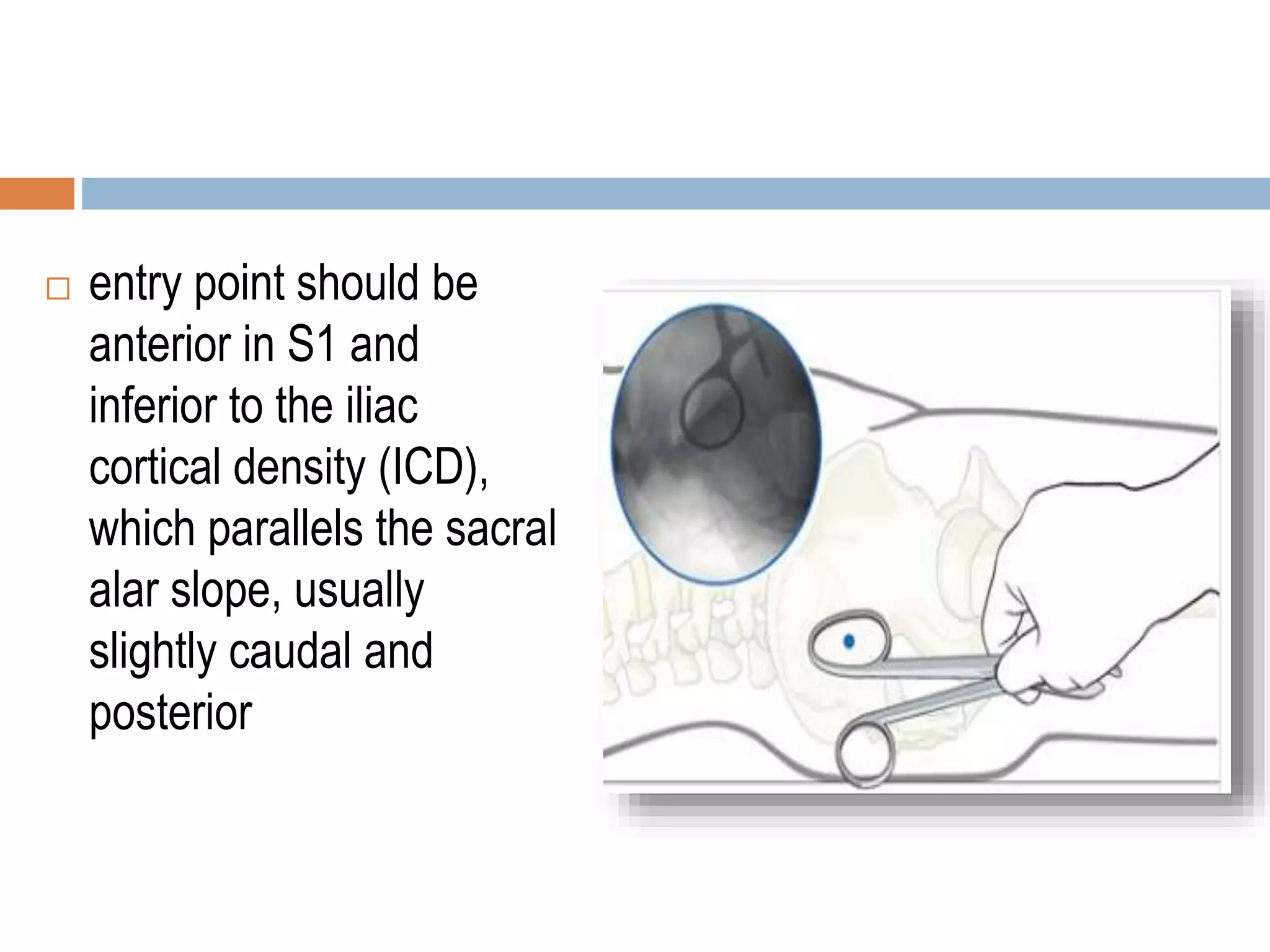 Sacral fractures.pptx