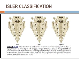 Sacral fractures.pptx