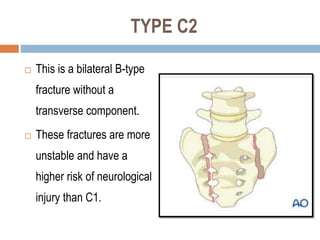Sacral fractures.pptx