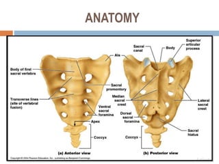 Sacral fractures.pptx