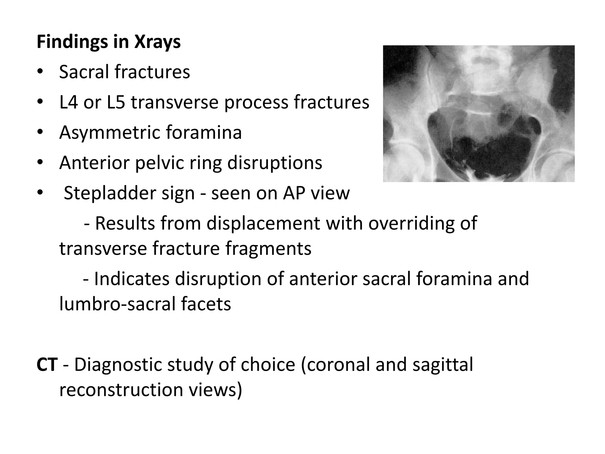 SACRAL FRACTURES.pptx