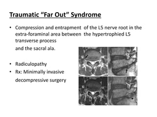 SACRAL FRACTURES.pptx