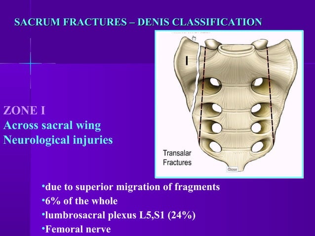 Sacral fractures | PPT | Death, Injury, or Military Conflict ...