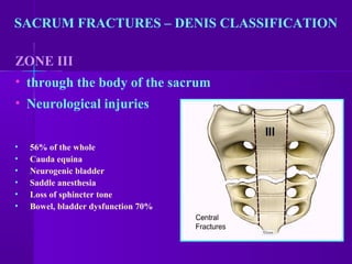 Sacral fractures | PPT